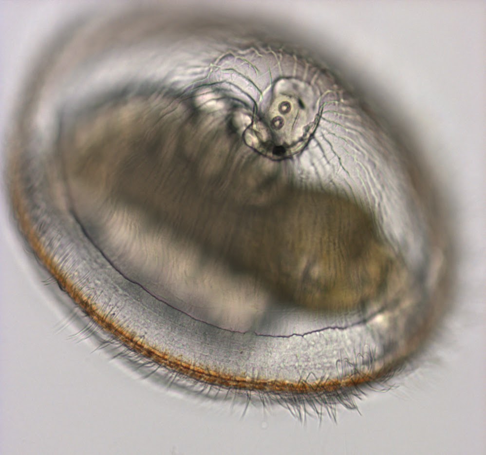 Invertebrate Embryology: Larva of Polygordius sp.