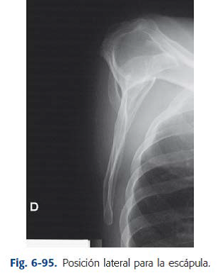 PRODUCCION Y TRATAMIENTO DE IMAGENES DIAGNOSTICAS: CAPITULO HUMERO Y ...