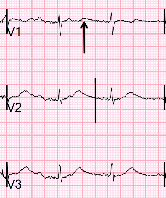 Dr. Smith's ECG Blog