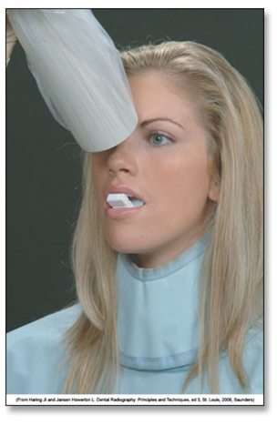 Dentistry and Medicine: Intraoral Radiographic Techniques (The ...
