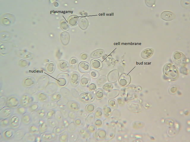 yeast in urine under microscope
