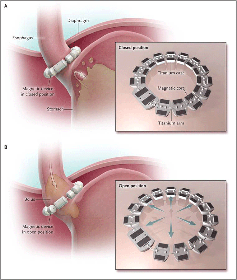 Michael Scally Md Mostly Androgens Magnetic Device For Treatment Of