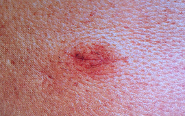 Consumir nutrientes que mejoren el sistema inmune