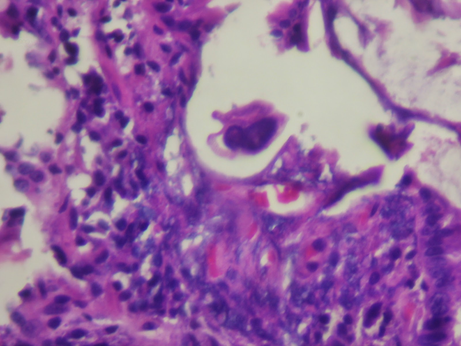 GASTROINTESTINAL AND LIVER HISTOLOGY PATHOLOGY ATLAS: DUODENUM ...