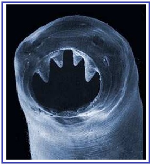 BIOLOGI GONZAGA: CACING TAMBANG