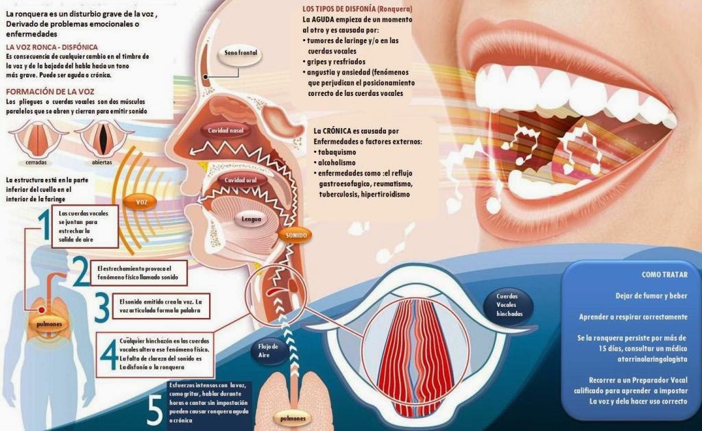 Infografía de una Disfonía | JUKEVOZ, La Voz es Noticia