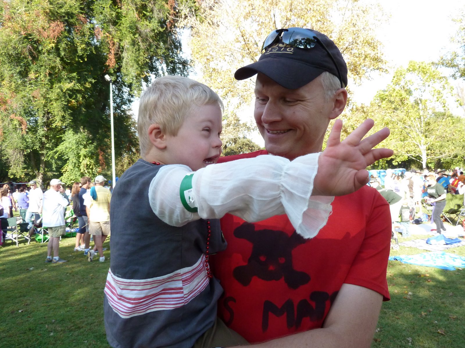 Monkeywith Down Syndrome : Deze dieren met het syndroom van down maken ...