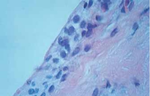 [Haematology] Atlas of Synovial Fluid | Free Medical Atlas