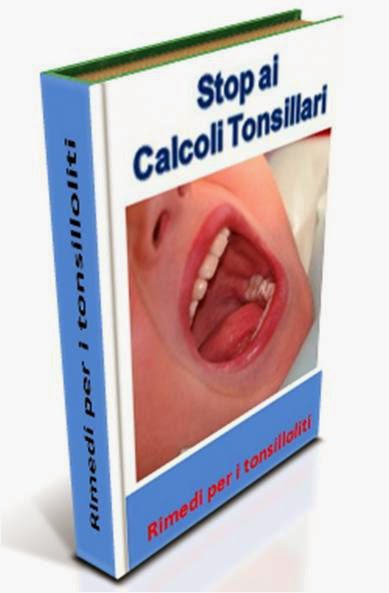 Calcoli tonsillari: Che cosa sono i calcoli alle tonsille