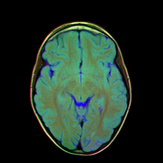 Nevit's blog: Color MRI of the Brain