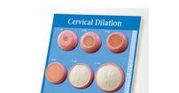 Childbirth Today: 3 Ways to Teach About Cervical Dilation