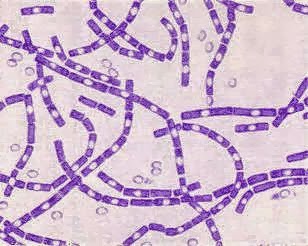 Bacillus anthracis- Characteristics and Morphology | Laboratory Stack