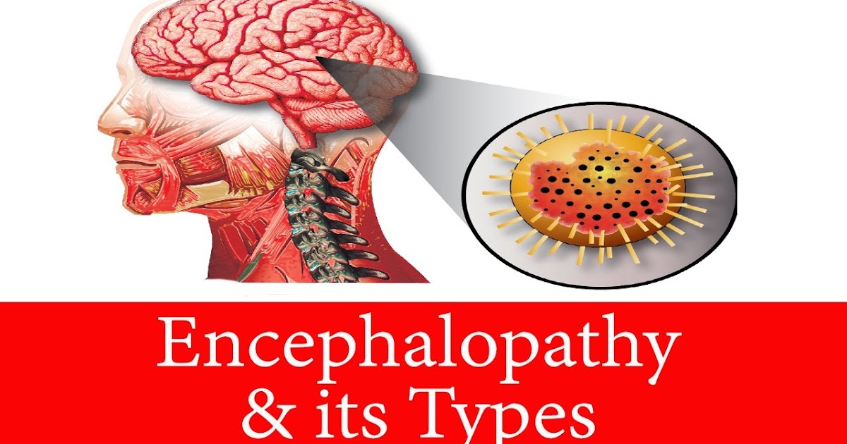 What Is Encephalopathy - Teroes