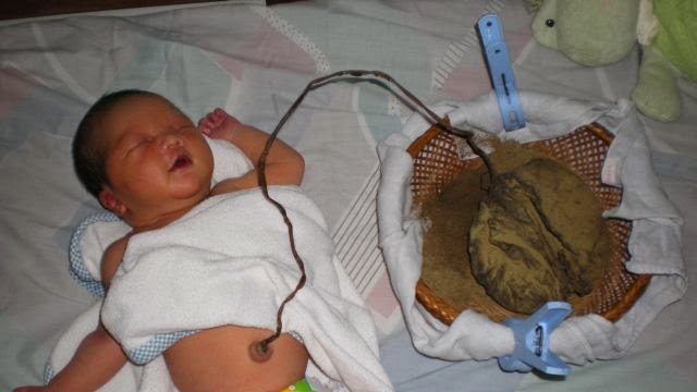 Diah Sarlita: Lotus Birth