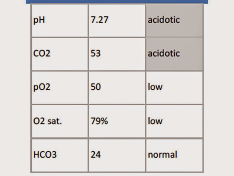 CARA MUDAH MEMBACA HASIL ANALISA GAS DARAH (AGD) - MUZARRO