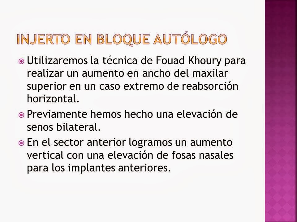 Escuela Implantológica Campos Clinicae: Injerto en Bloque Autólogo