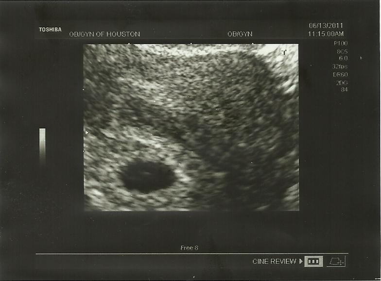 TBC: Real Pictures from Inside the Human Body