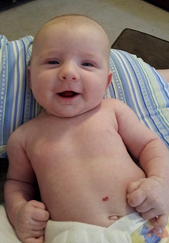 Bountiful Butterflies: Today's Lesson: Birthmarks