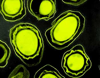 Mini-Mikro: Spora Bakteri di Makanan Kita! ~ dunia-mikroorganisme