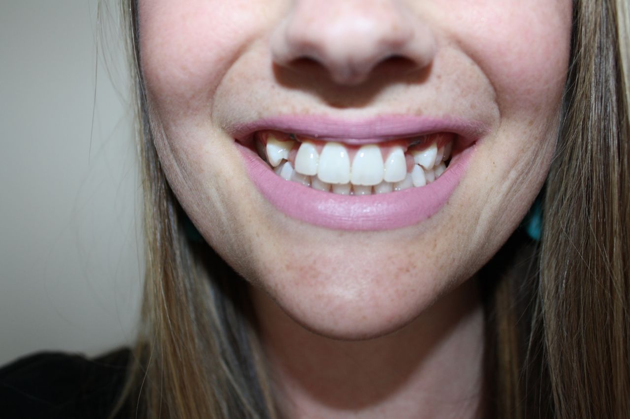 The Roberts Family: Teeth