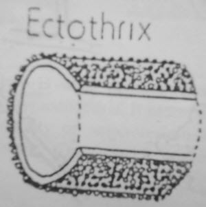 DERMATOPHYTOSIS | All Microbes