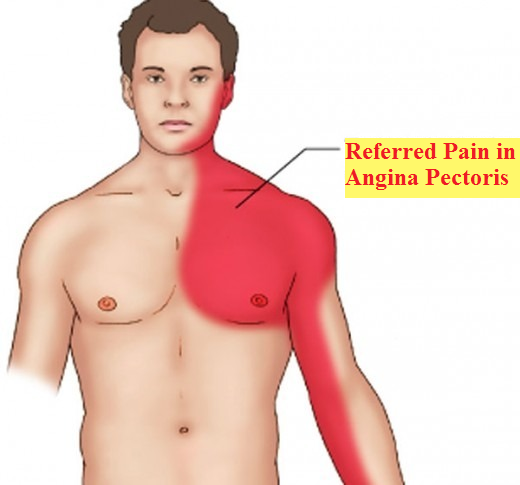Pharmacology Angina Pectoris Pharmacology Angina Pectoris