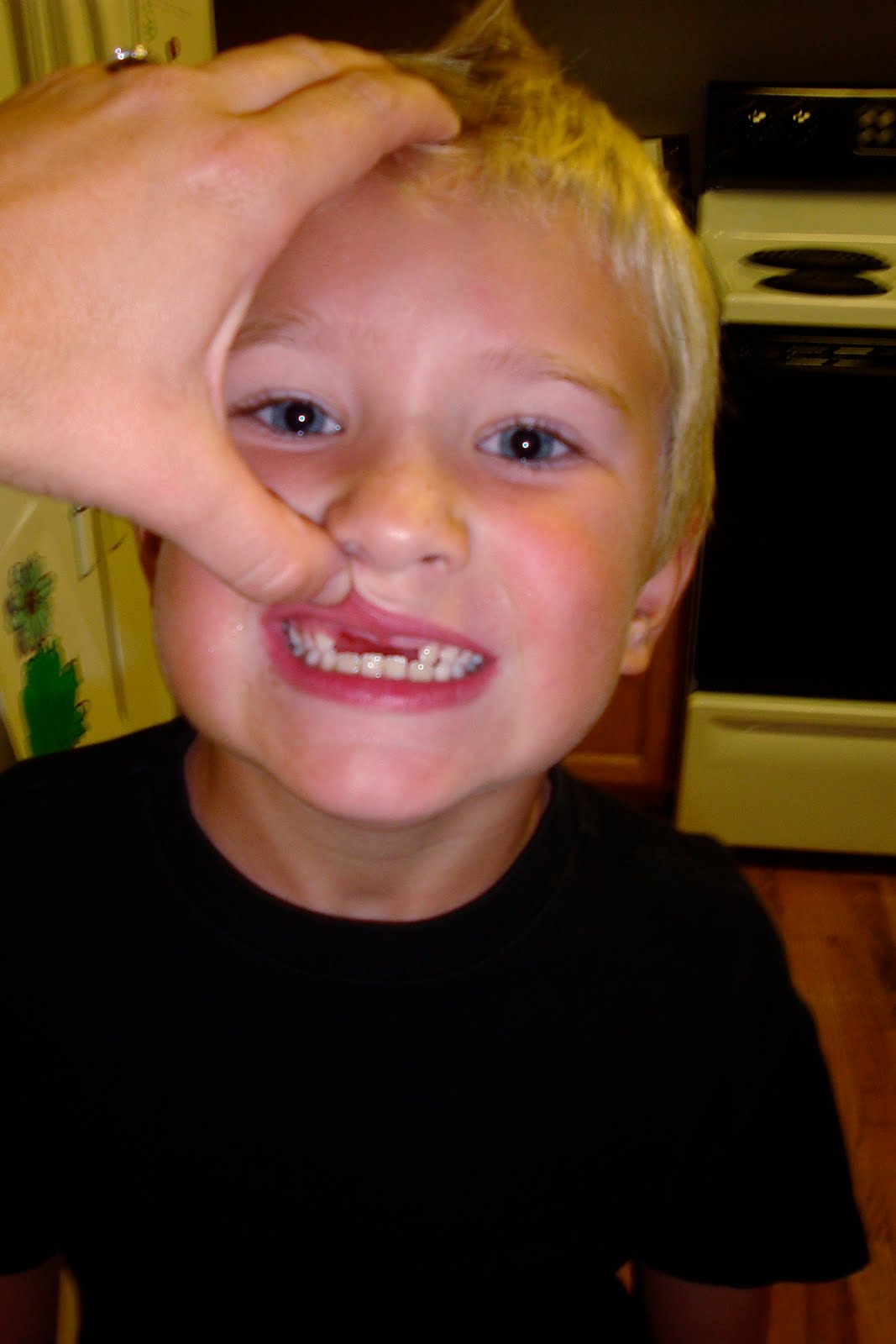 ELLINGSON: Snaggle Tooth