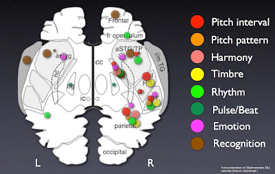 Music Matters | A blog on music cognition: Which brain areas are ...