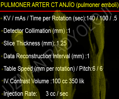 PULMONER TROMBOEMBOLİ