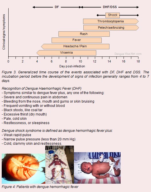 Dengue Shock Syndrom (DSS) | INFONOTO