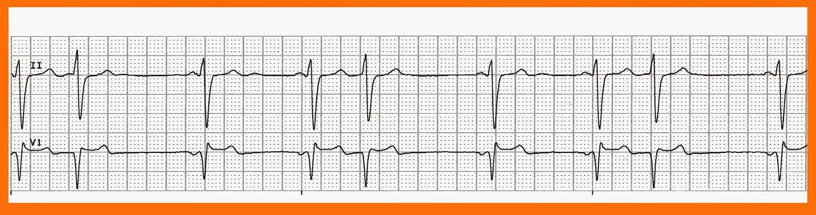 Various Rhythms with PJCs