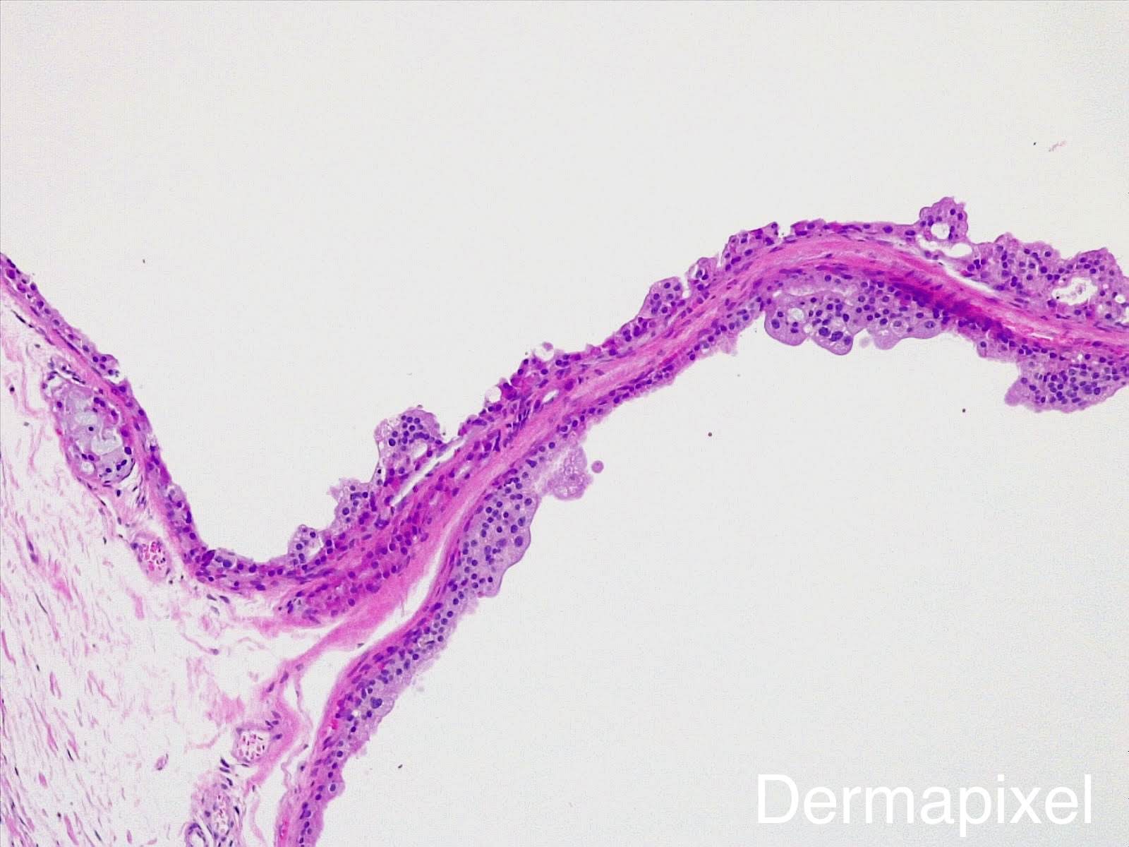 Dermapixel: mayo 2018