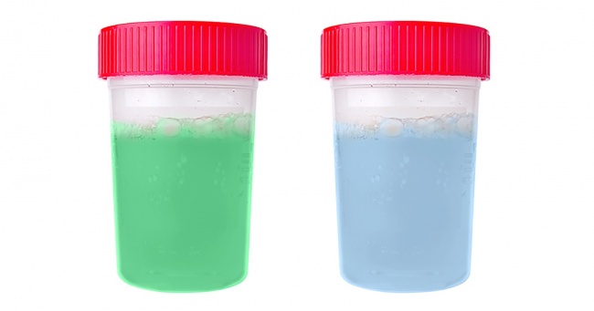 Curiosidades e dicas: 7 FATOS QUE A URINA INDICA SOBRE A SAÚDE DO SEU ...