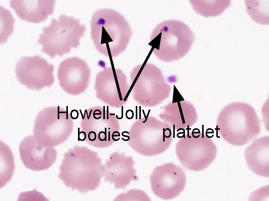 Howell Jolly Bodies