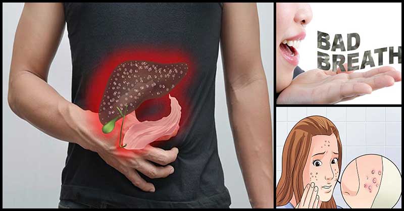 Clear Signs Our Liver May Be Full Of Toxins | Dr Farrah MD