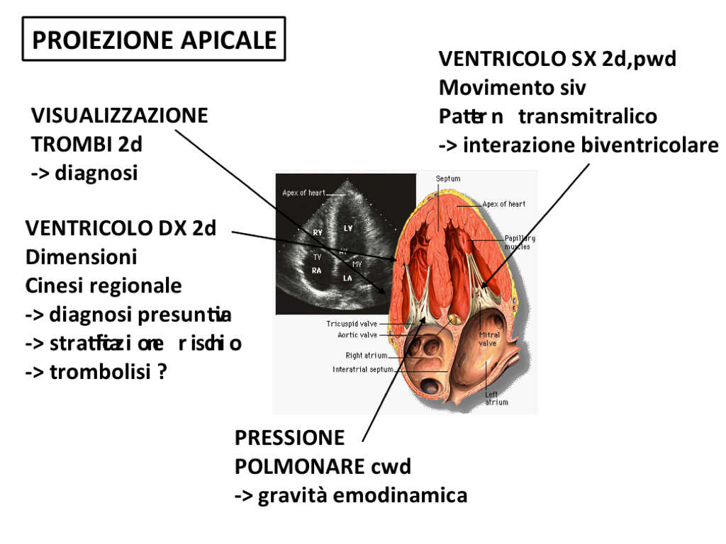 Manuali di Medicina Intensiva: Embolia polmonare - management e terapia ...