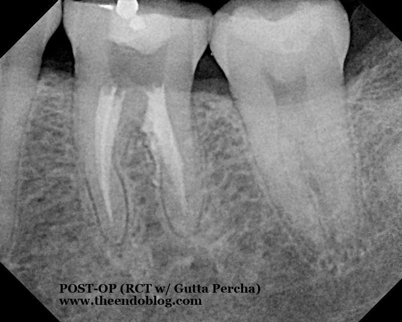 AJIDS e - Library.: A look into the clinical practice of endodontics.