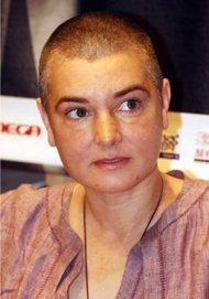 Baldness: Famous bald women