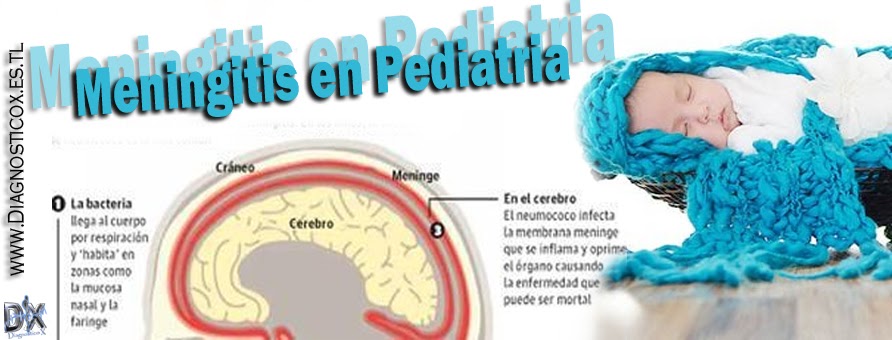 Diagnostico X: Meningitis Bacteriana en Pediatria
