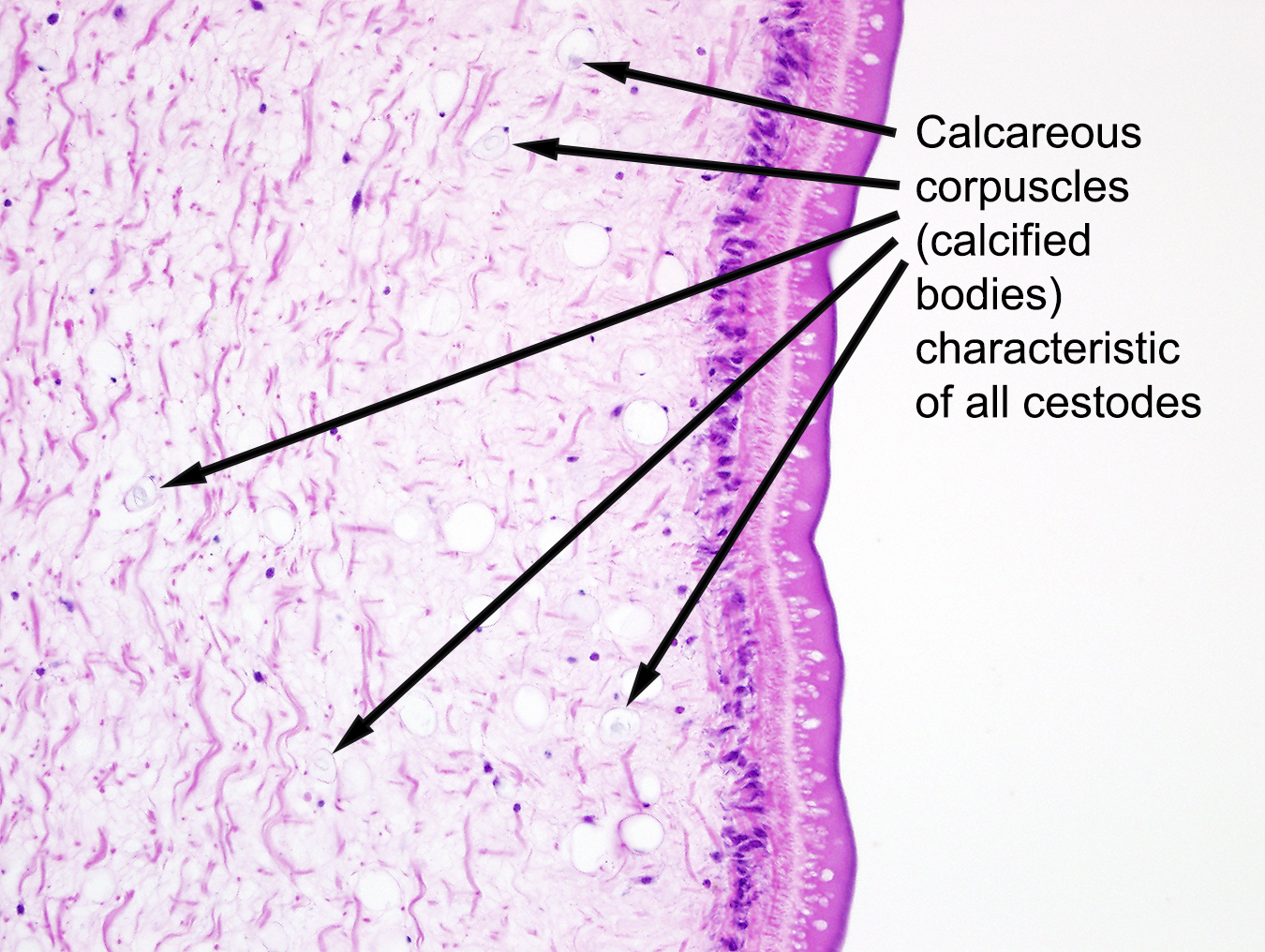 Creepy Dreadful Wonderful Parasites: June 2015