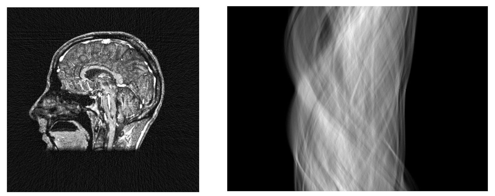 Intermediate Physics for Medicine and Biology: The Sinogram