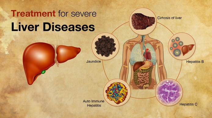Menjaga Kesehatan Hati Atau Liver ~ Kecantikan Dan Kesehatan