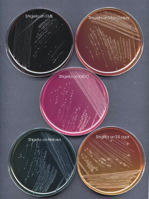 BACTERIOLOGIA: Shigella