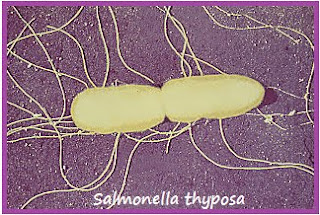 START YOUR DAY WITH...BISMILLAH: Salmonella typhosa Dibalik Penyakit Tifus