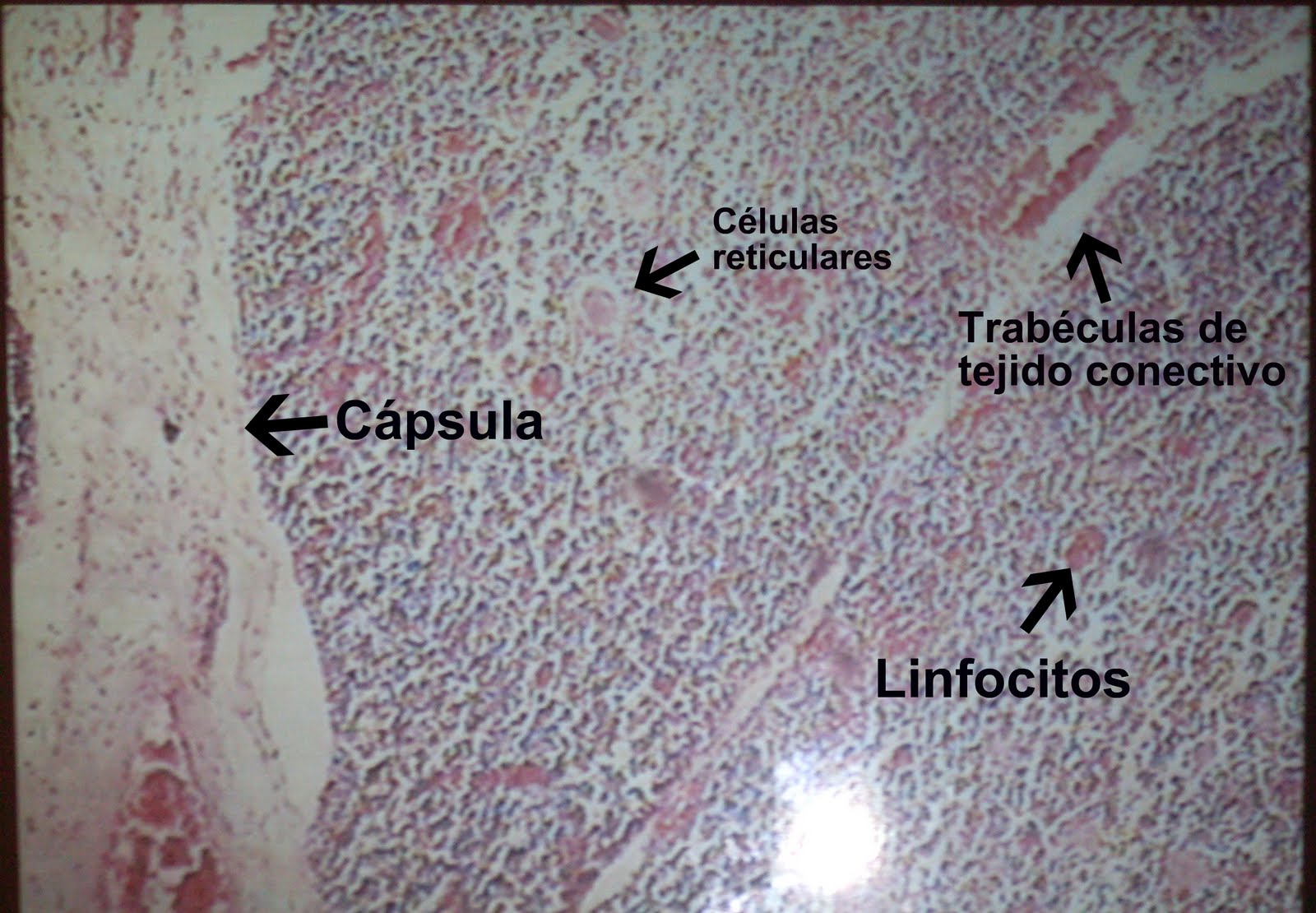 Fisiologia del Tejido Linfatico