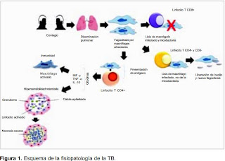 Patologia Respiratorias: Tuberculosis, Definicion, fisiopatologia, Dx ...