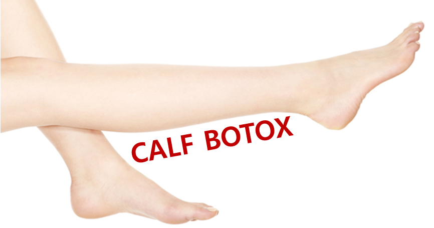 Renewme Skin Clinic: Get Sexy Summer Legs with Calf Botox