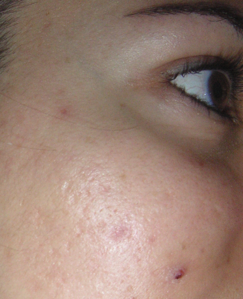 Paris Tries: I'm Still Standing...Yeah, Yeah, Yeah (Part One)