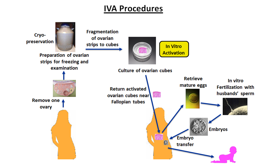Ob/Gyn Updated : New hope for infertility patients with premature ...