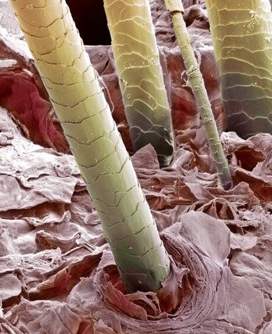 Medical and Health Science: Human hair, colored SEM. Hair shafts ...